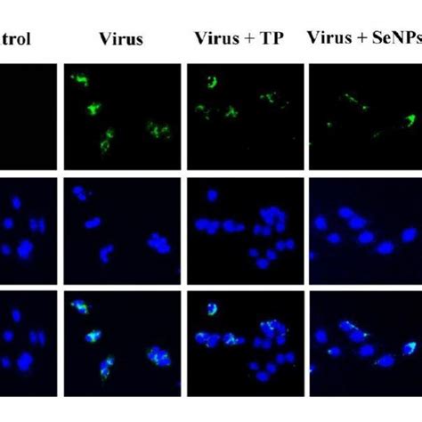 Setp Induced Apoptosis In H1n 1 Infection Of Mdck Cells Dna
