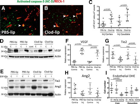 Microglial Cells Prevent Hemorrhage In Neonatal Focal Arterial Stroke Journal Of Neuroscience