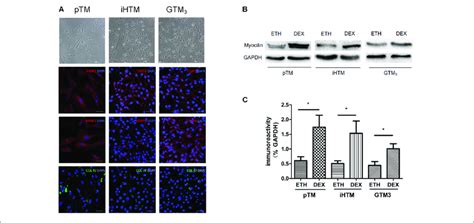 Characterization Of Primary Human Trabecular Meshwork Ptm Cells And Download Scientific