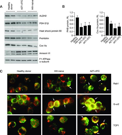 Validation Of Proteomic Data On Individual HIV Infected Patients Download Scientific Diagram