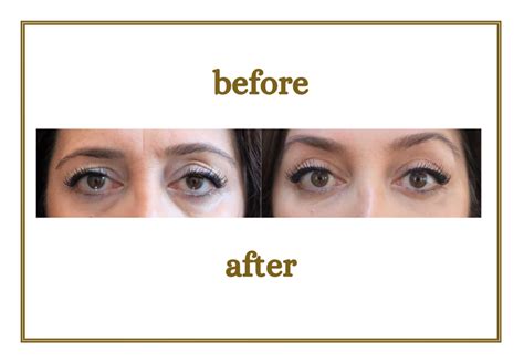 Meet Dr Lee A Renowned Oculo Facial Plastic Surgeon Known For His