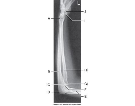Ria Ch 4 Fig 4 63 Lateral Forearm Quiz