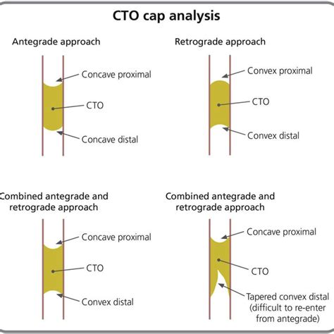 Chronic Total Occlusion Cto Cap Analysis Download Scientific Diagram