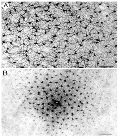 Myriad Roles For Gap Junctions In Retinal Circuits Webvision