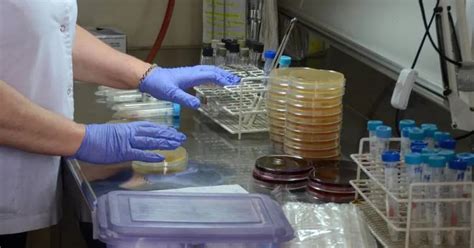 Streptococcus Pyogenes Ya Suman 17 Las Muertes En Todo El País Por La