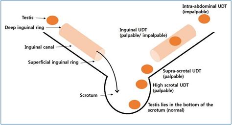 Normal Testis Position