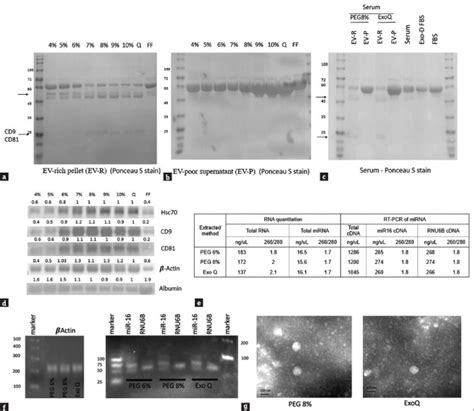 A Simple Economical And High Yield Method For Polyethylene Glycol Based Extraction Of