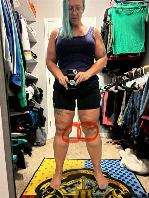 Any Exercises That Target This Area Ive Had Those For So Long No Matter How Much Ive Lost