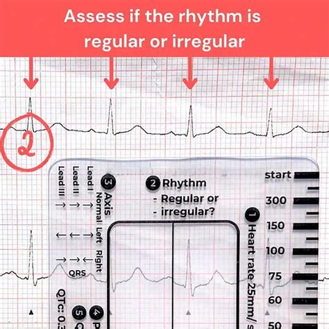 Ecg 7 Step Ruler Ecg 7 Step Ruler For Ecg Ekg Interpretation Ecg