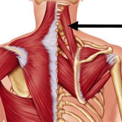 Trigger Point Therapy Levator Scapulae Taping Procedure Levator