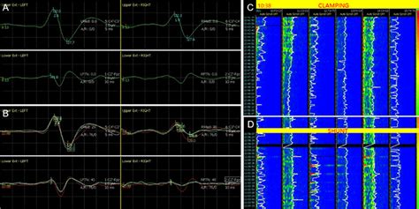 Join Journal Of Intraoperative Neurophysiology