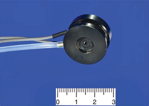 Skin Elasticity As A Measure Of Radiation Fibrosis Is It Reproducible And Does It Correlate