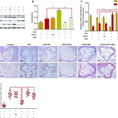 Autophagy Is Involved In The Inhibition Of As By Fgf21 Apoe−− Mice