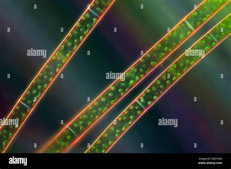 Spirogyra Algae Polarised Darkfield Illuminated Light Micrograph Of Spirogyra Sp Algae This