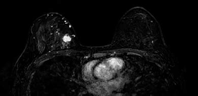 Whole Body Imaging Gallery Fujifilm Philippines