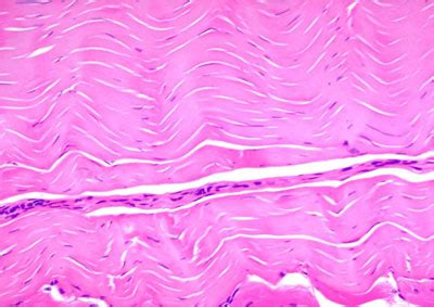 Dense Regular Connective Tissue Histology