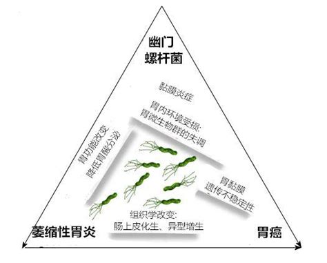 萎縮性胃炎也是胃癌前奏！醫生提醒：做好這些預防，降低得癌風險 每日頭條