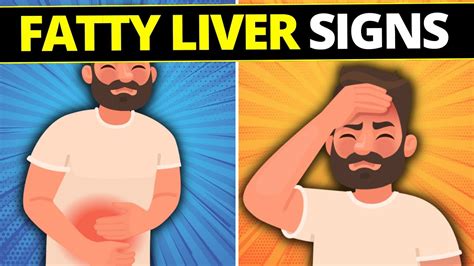 5 Warning Signs Of Fatty Liver 🤮 Youtube