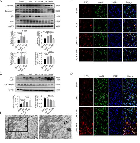 Figure 5 From The Pannexin 1 Channel Regulates Pyroptosis Through