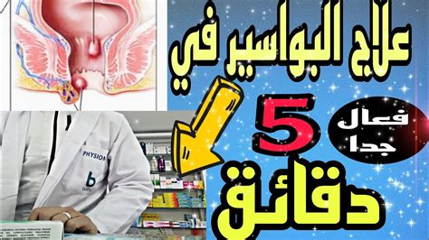 تخلص من البواسير علاج البواسير الداخلية والخارجية بطريقة سهلة Youtube