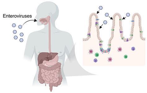 Enteroviruses Creative Diagnostics
