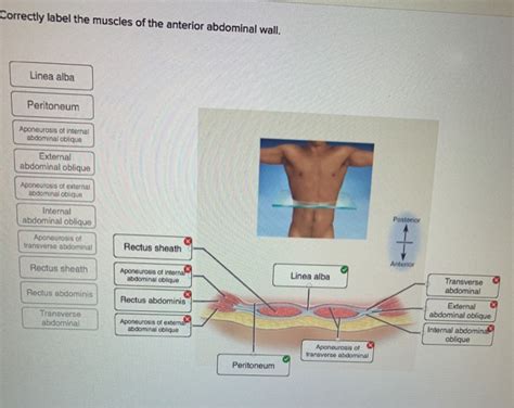 Solved Correctly Label The Muscles Of The Anterior Abdominal