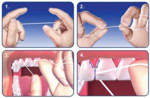 Síntesis de 28 artículos como usar el hilo dental actualizado