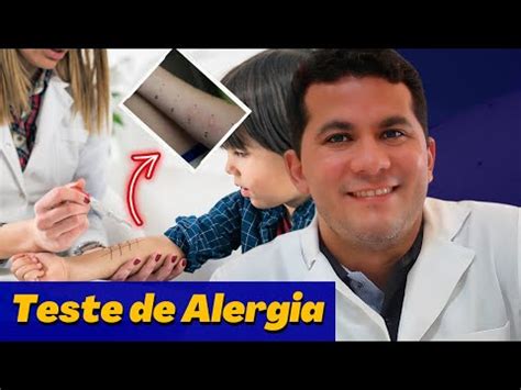 Alergia a corante principais sintomas e o que fazer 3 видео Med