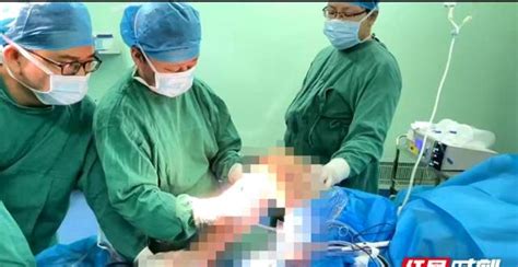 全市首例！张家界中年男子因打球致韧带断裂 医生采用“人工韧带”为其重建腾讯新闻