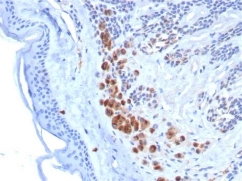 Tyrosinase Related Protein 1 Tyrp 1 Melanoma Marker Recombinant