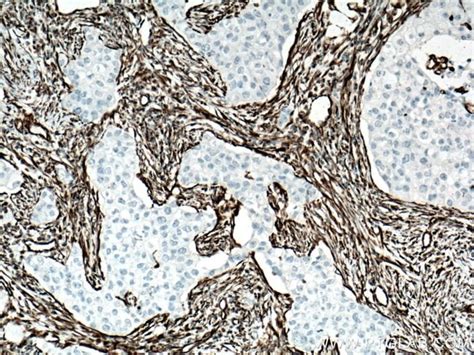 Vimentin Mouse Anti Human Mouse Rat Clone 3h9d1 Proteintech 150 μl