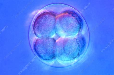 Sea Urchin Embryo Development Stock Image C0131948 Science Photo