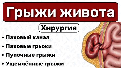 Операции на грыжах слабые места паховые грыжи пупочные грыжи Хирургия Youtube