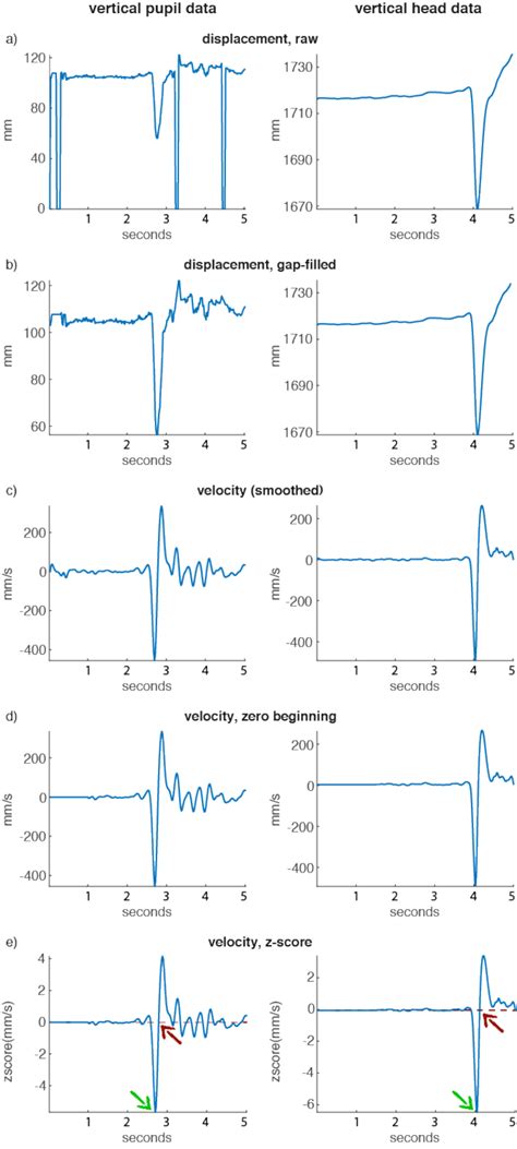 Workflow Of The Synchronization Procedure A Vertical Displacement Of