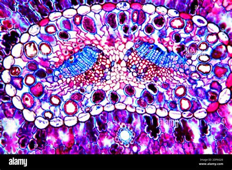 Xylem Plant Tissue Microscope Micropedia
