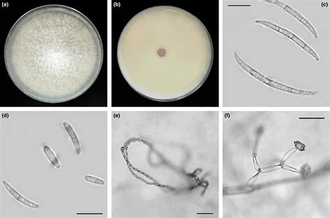 Fusarium Solani Spores