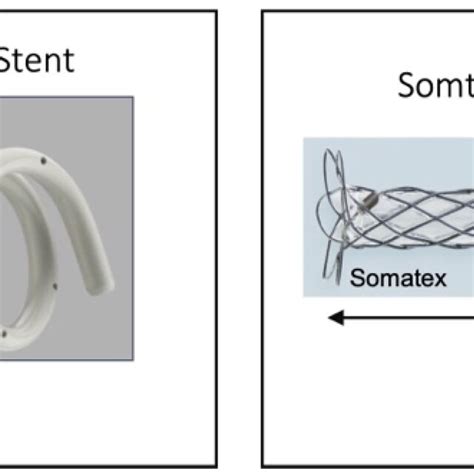 Types Of Shunts Used For Vesicoamniotic Shunting Download Scientific