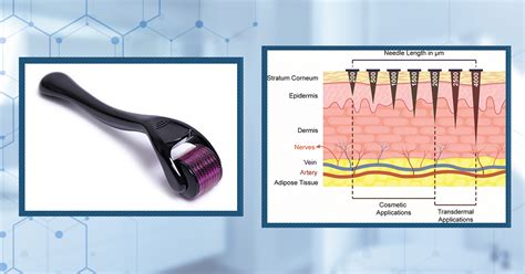 Microneedling The Scalp Does It Cause Scarring