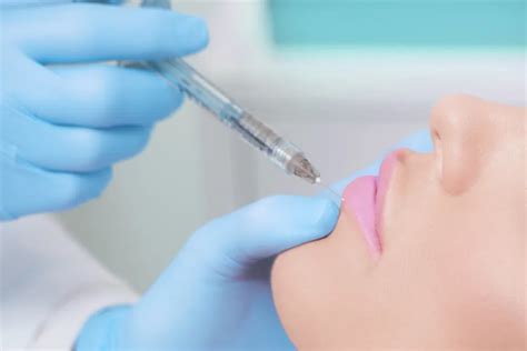 Lip Fillers Miami Beginners Guide To Natural Enhancement