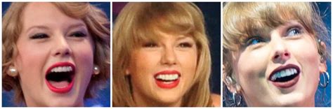 Taylor Swifts Teeth Are They Real Longevita