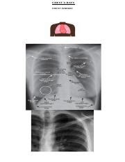 Interpreting Chest Abdominal X Rays A Comprehensive Guide Course Hero