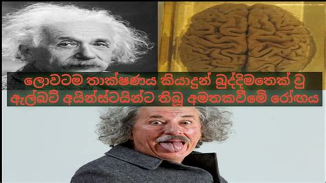 ලොවටම තාක්ෂණය කියාදුන් බුද්දිමතා ඇල්බට් අයින්ස්ටයින්ට තිබු අමතකවන රෝඟය