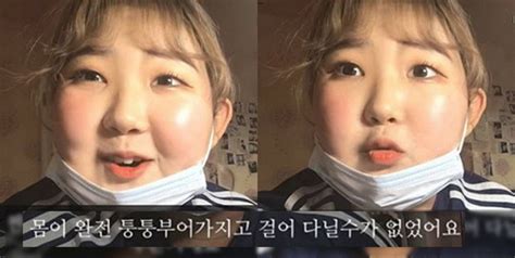 희귀난치병 ‘루푸스 투병 고백한 ‘故 최진실 딸 최준희 인사이트