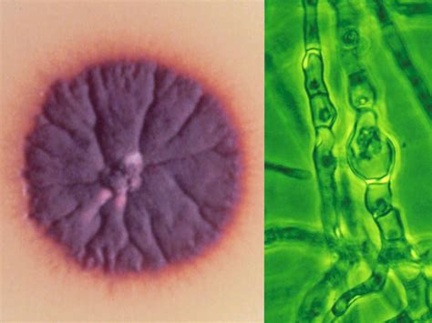 Trichophyton Mycology University Of Adelaide
