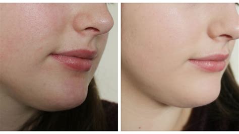 How To Get Glowing Skin At Home Youtube