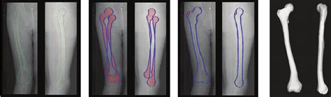 3d Femur Shape Reconstruction From Two X Ray Images Download Scientific Diagram