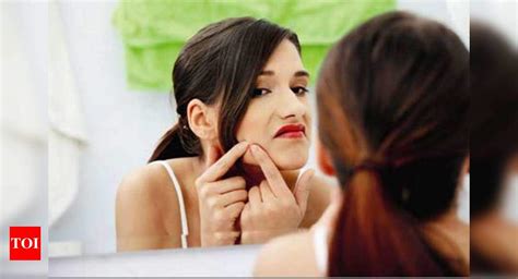 How To Take Care Of A Pimple Times Of India