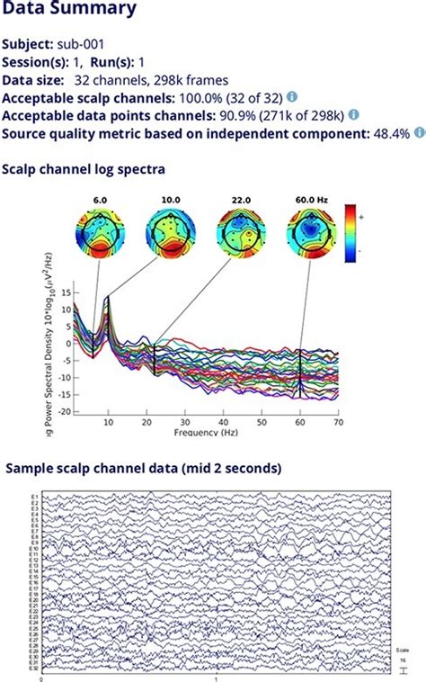 Nemar An Open Access Data Tools And Compute Resource Operating On Neuroelectromagnetic Data Pmc