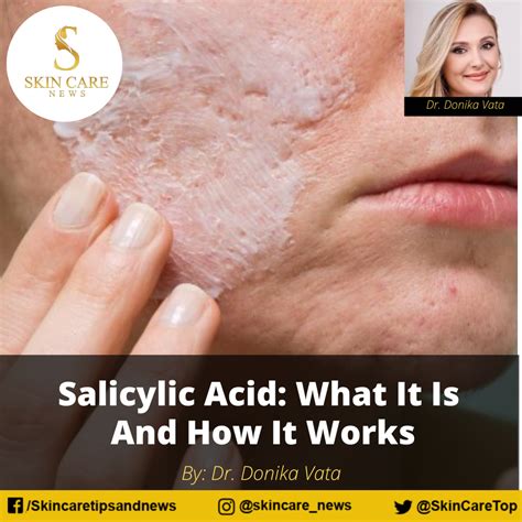How Does Salicylic Acid Work On Corns At Kathaleen Velasquez Blog
