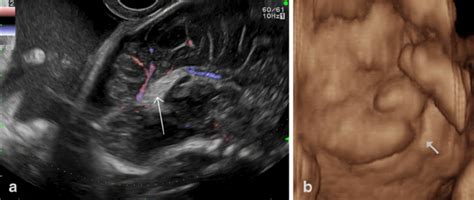 Fetal Sonography At 24 Weeks Gestation A 2 D Doppler Us Image Of The